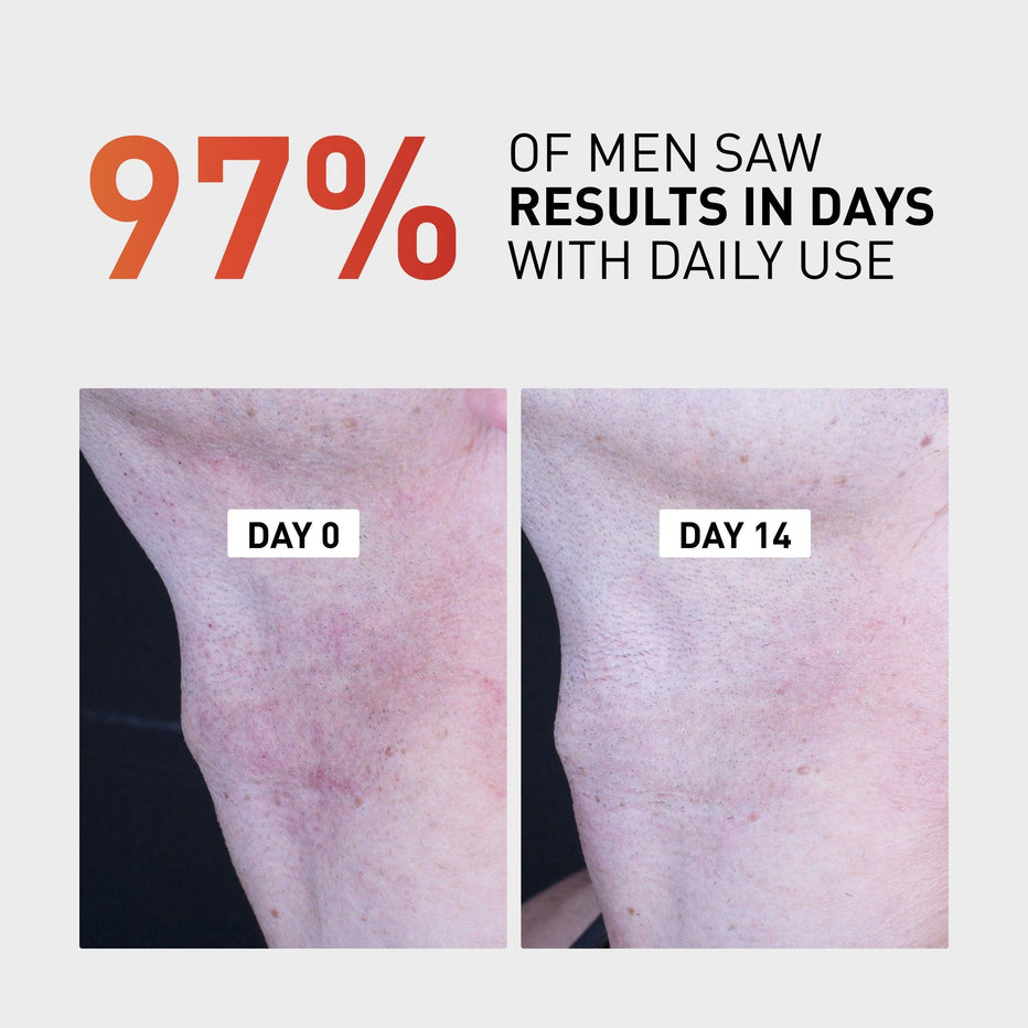 Post Shave Razor Bump Treatment & Cream | Frederick Benjamin