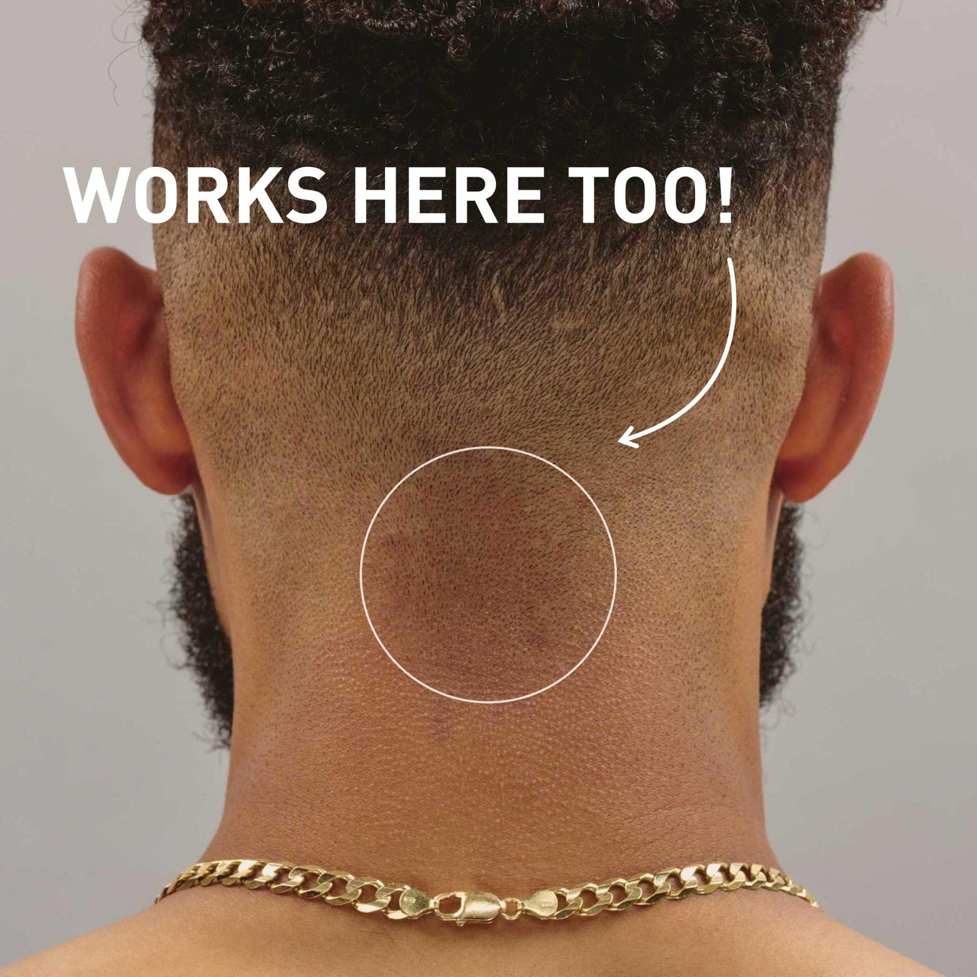 Post Shave Razor Bump Treatment & Cream | Frederick Benjamin