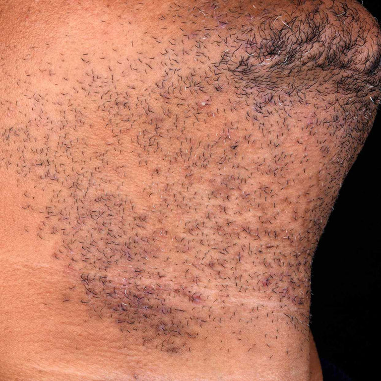 Post Shave Razor Bump Treatment & Cream | Frederick Benjamin